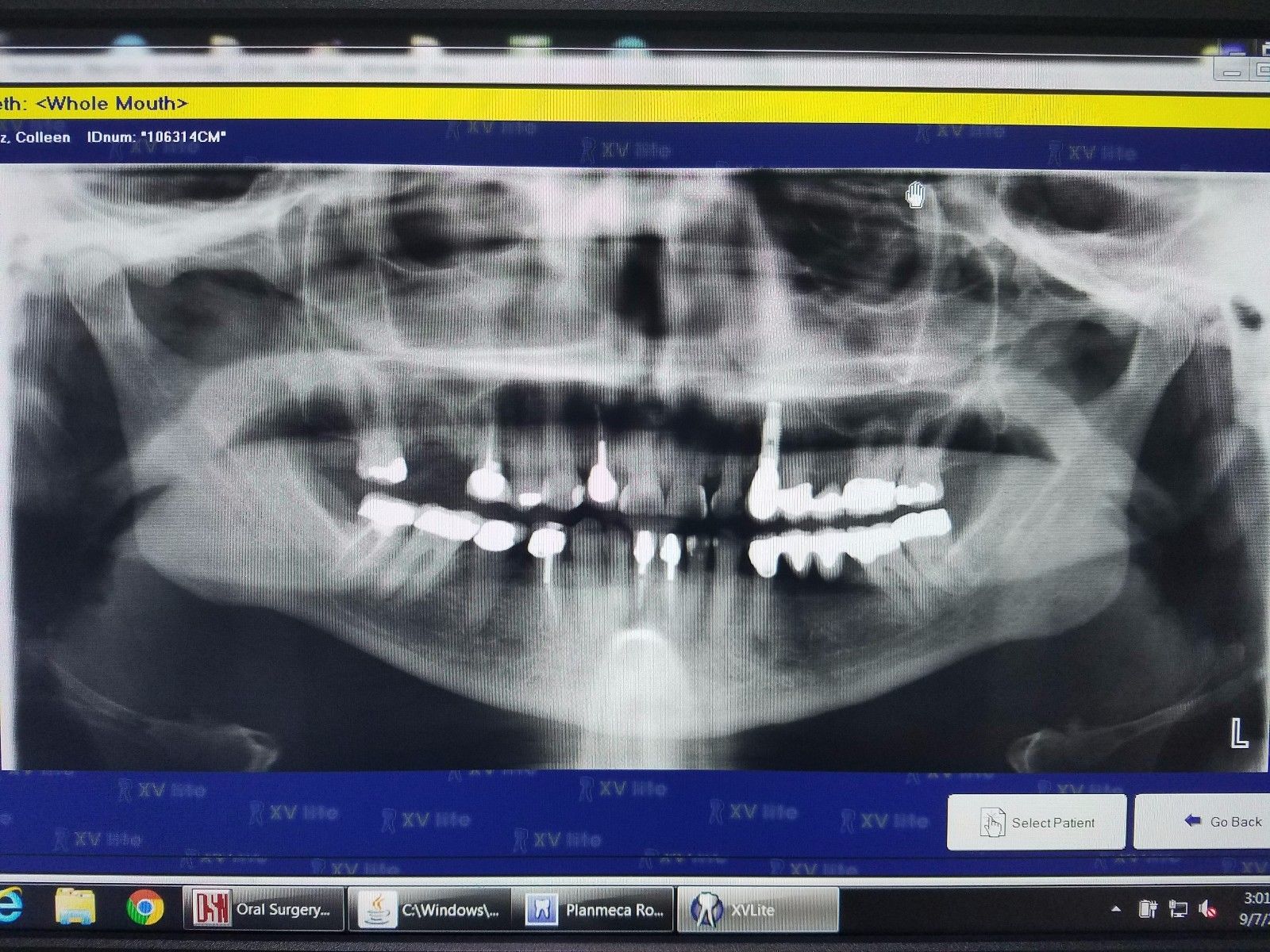 Planmeca Promax Classic 2D+3D+CBCT | Tools For Sale | Atlanta, GA | Shoppok