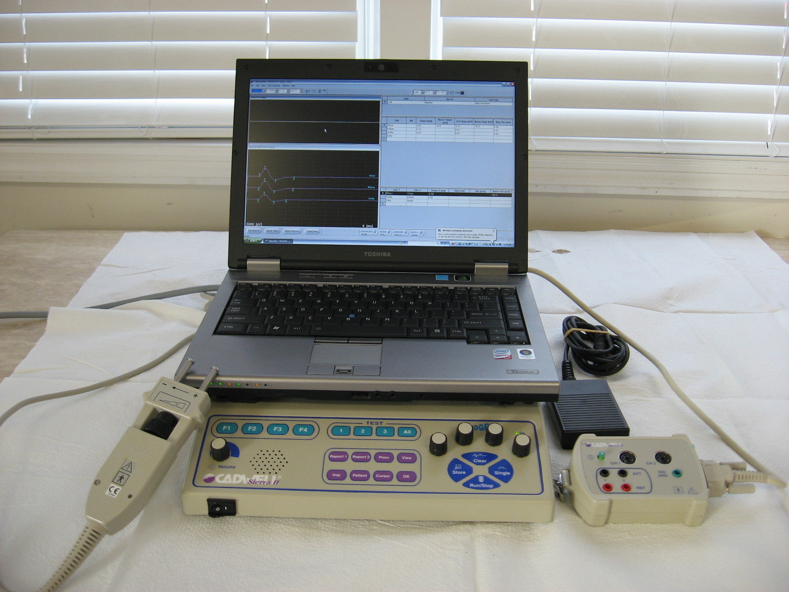 Cadwell Sierra Wedge EMG/NCV/SSEP System | Electronics For Sale ...